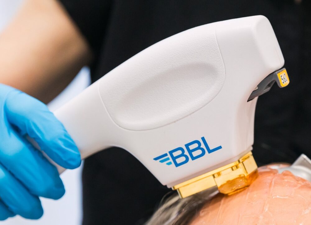 BBL Hero in Florence | Derm Aesthetics of NK